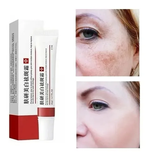 Pomada Creme Removedor Clareador Melasma Manchas Sardas à Venda Em