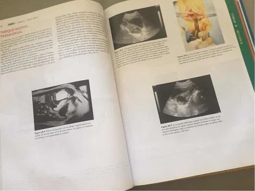 Libro Medicina Atlas Anatomía De La Pelvis Y Cirugía Gineco En Venta En