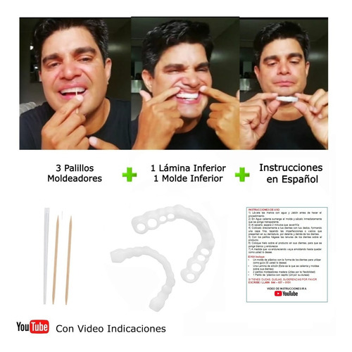 Carillas Dentales Dientes Postizos Temporal Fundas Cosmetic | Meses sin ... Carillas Dentales Dientes Postizos Temporal Fundas Cosmetic | Meses sin ...