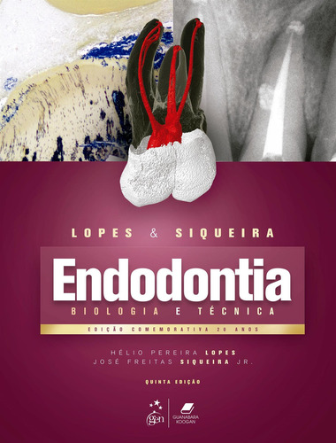 Endodontia - Biologia e Técnica, de LOPES, Hélio Pereira. Editora Gen ... Endodontia - Biologia e Técnica, de LOPES, Hélio Pereira. Editora Gen ...