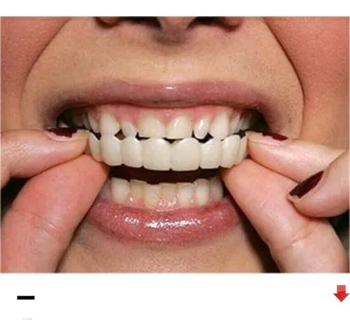 Carillas Dentales Dientes Postizos Temporal Fundas Cosmetic | MercadoLibre Carillas Dentales Dientes Postizos Temporal Fundas Cosmetic | MercadoLibre