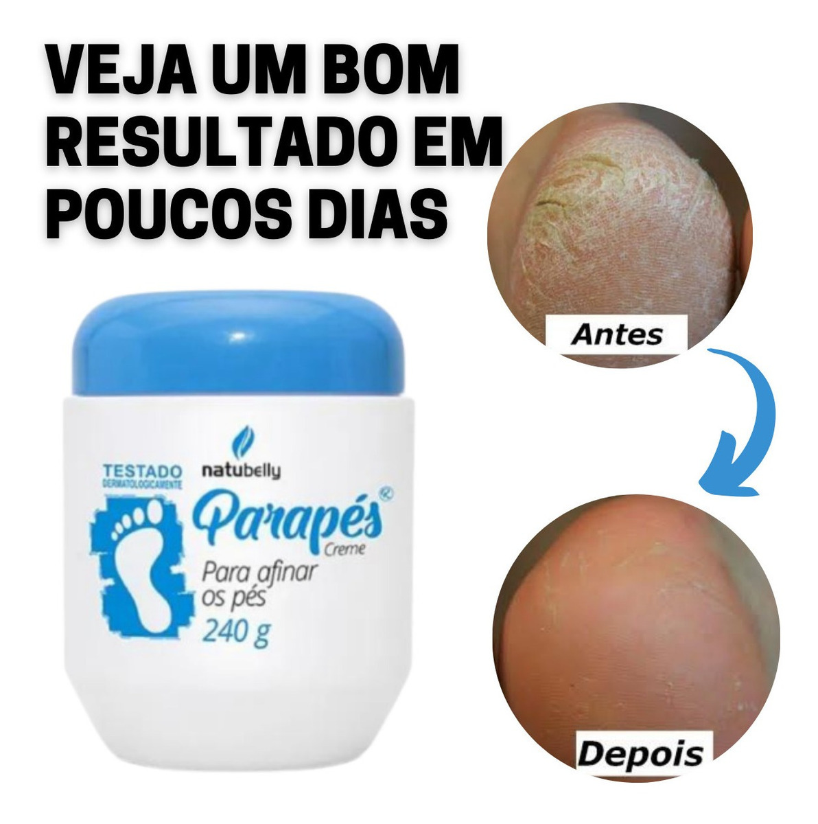 Hidratante Creme Para Afinar Para Os Pés Rachaduras Parapés | MercadoLivre Hidratante Creme Para Afinar Para Os Pés Rachaduras Parapés | MercadoLivre
