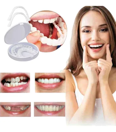 Carillas Dentales Dientes Postizos Temporal Fundas Cosmetic | Meses sin ... Carillas Dentales Dientes Postizos Temporal Fundas Cosmetic | Meses sin ...