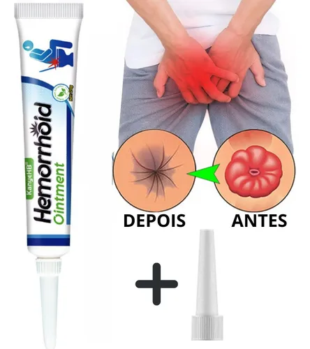 Pomada Creme Medicina Ervas Alívio Hemorroida Fissuras Mercadolivre