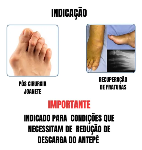 Sandália Baruk Ortopedica Cunha Antepé Bilateral Joanete Sandália Baruk Ortopedica Cunha Antepé Bilateral Joanete